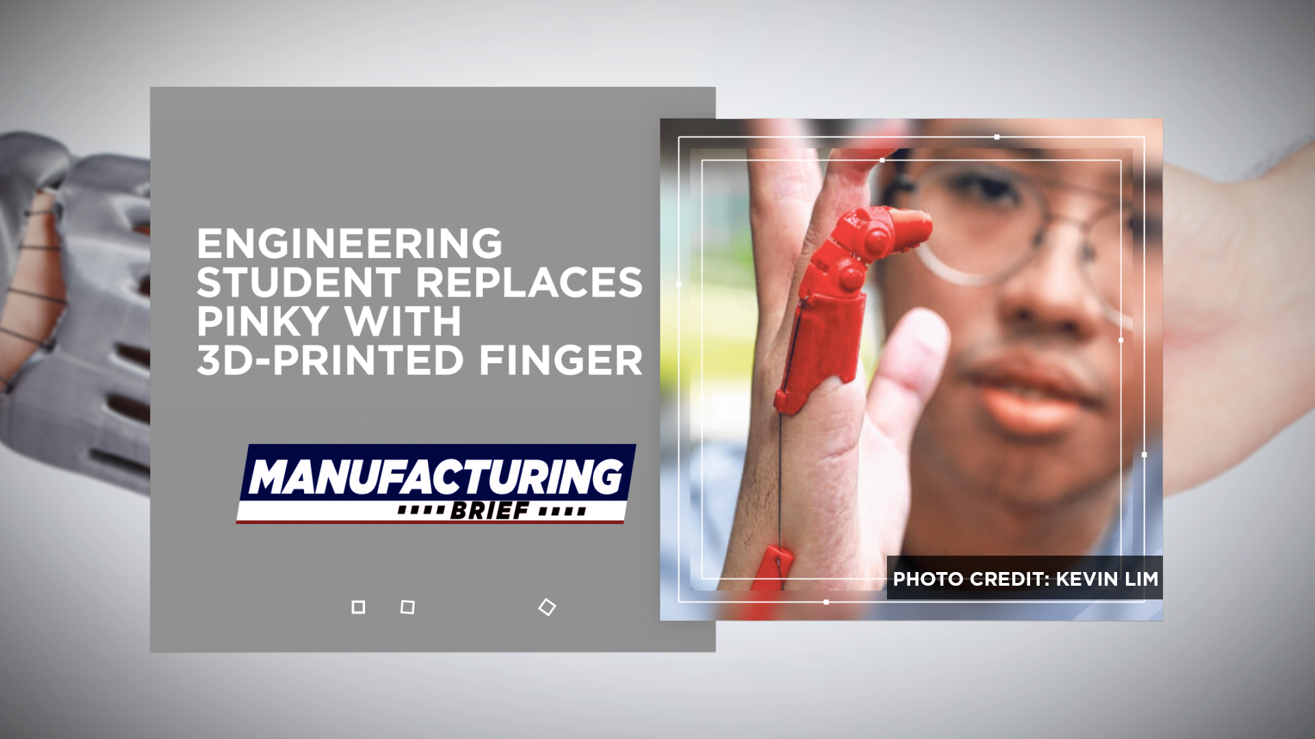 Engineering Student Replaces Pinky With 3D-Printed Finger | Industrial ...